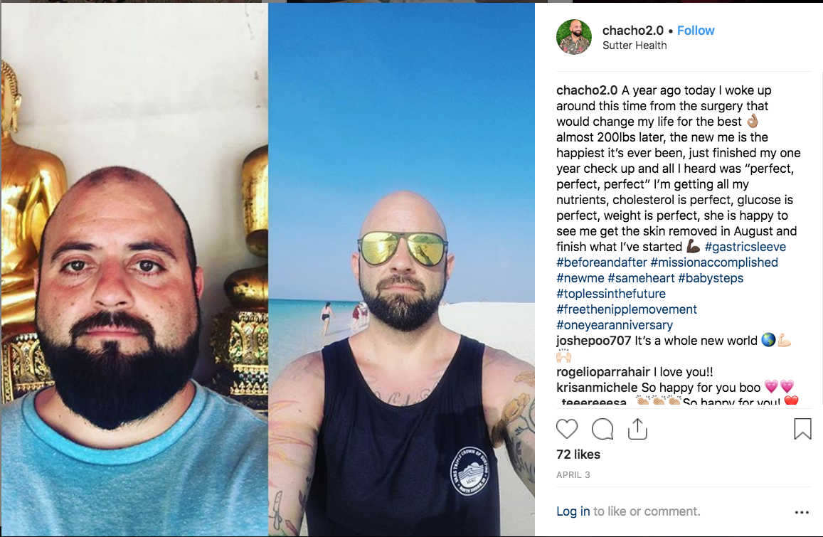 Chef Sergio Valencia's Body Lift Transformation - Poulos, Stanley ...